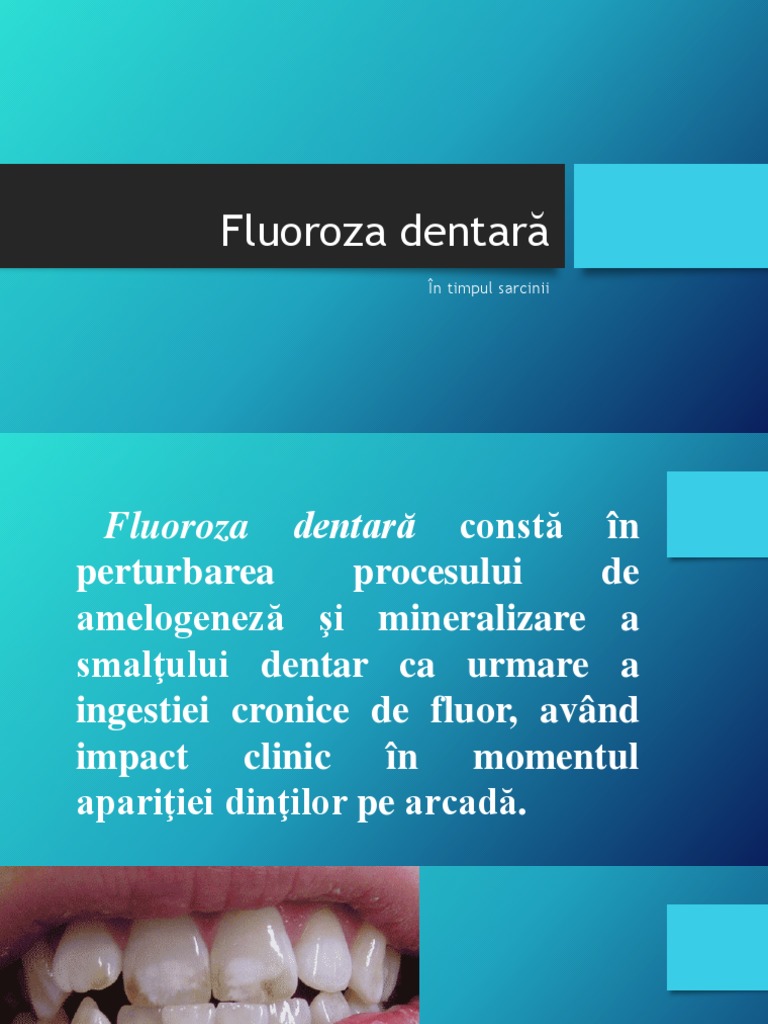 Fluoroza Dentară | PDF