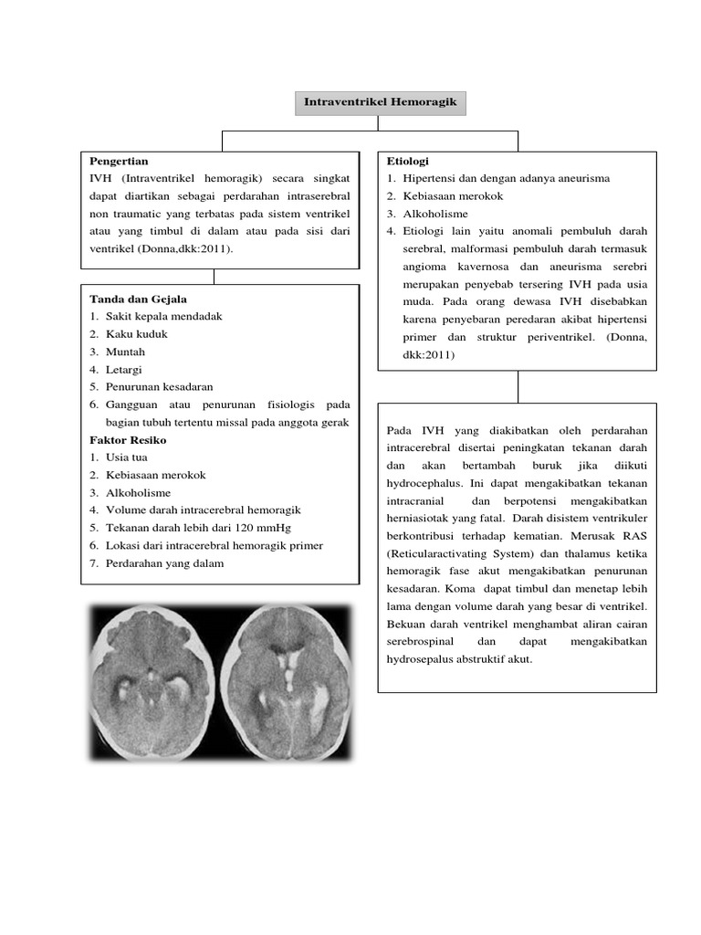 Stroke Center LP IVH (Maping) | PDF