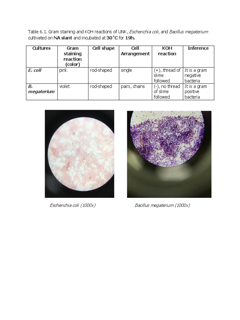 Gram Staining Results of E. coli & B. megaterium | PDF
