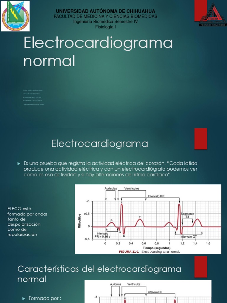 Electrocardiograma Normal (1) | Electrocardiografia | Corazón