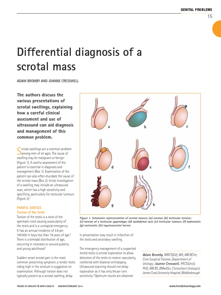 Dd Scrotum | Clinical Medicine | Health Sciences