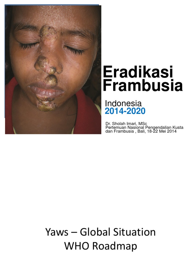 Eradikasi Frambusia | PDF