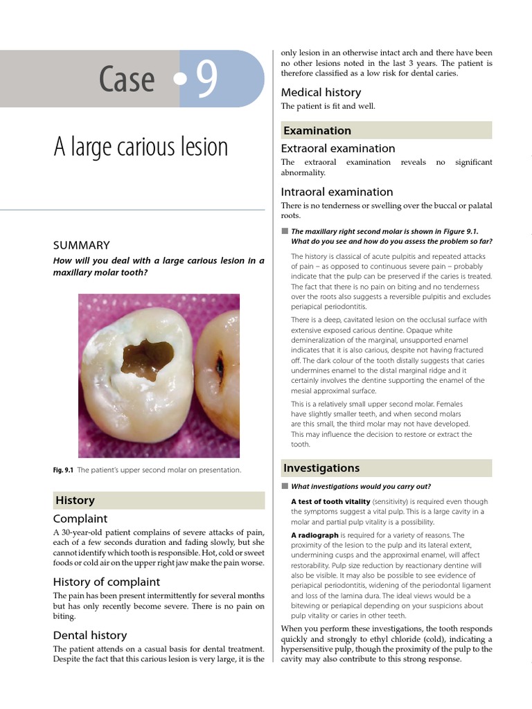 9-A Large Carious Lesion | PDF | Dentin | Tooth Enamel