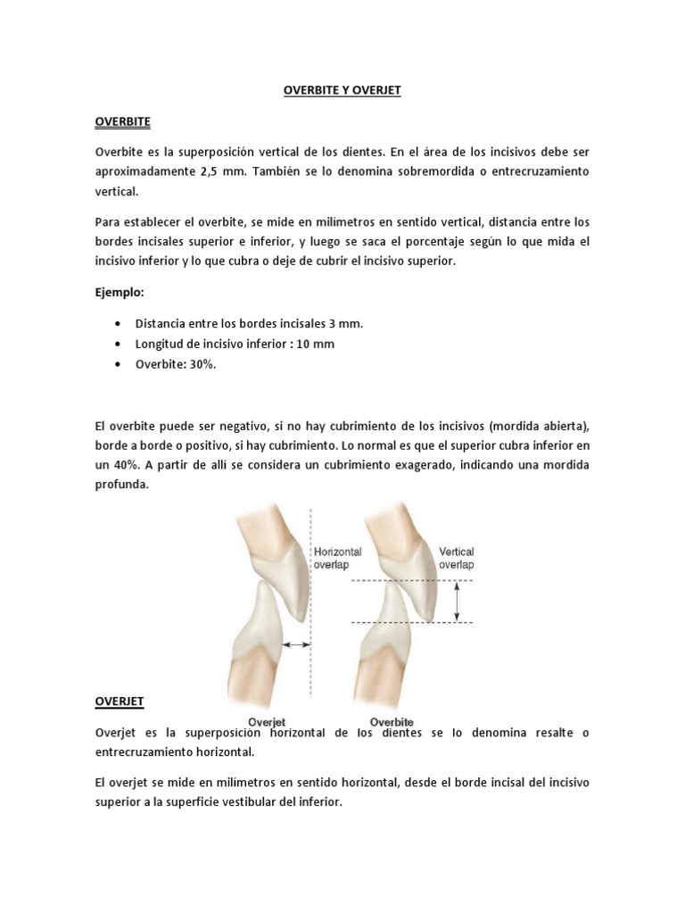 Overbite Overjet | PDF | Anatomia dental | Boca