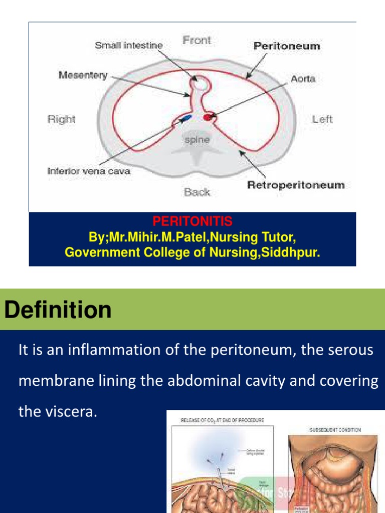 Peritonitis ppt | Peritoneum | Gastroenterology