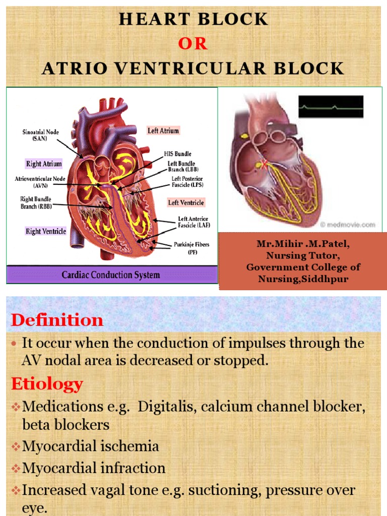 Heart Block | PDF | Cardiac Arrhythmia | Heart