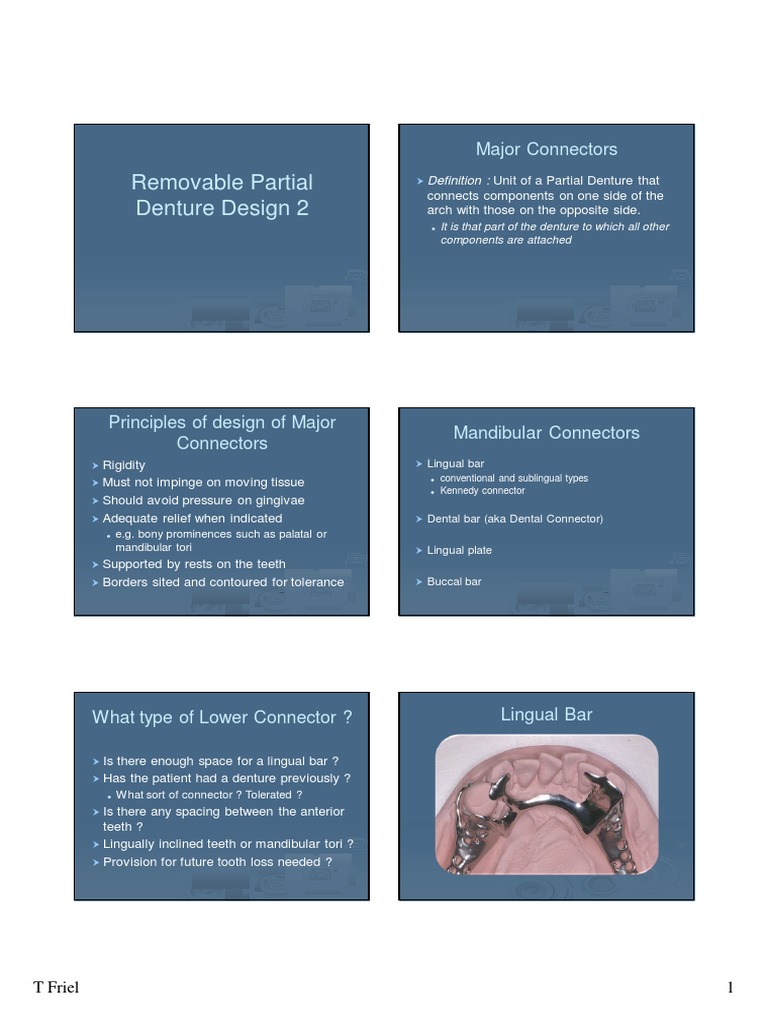 RPD Design 2 | PDF | Dentures | Human Head And Neck