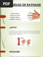 Punto de McBurney | PDF | Abdomen | Síntomas y signos