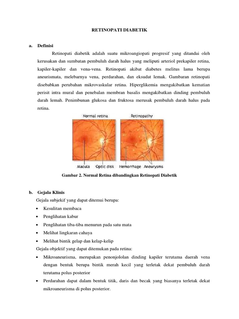 Retinopati Diabetik | PDF