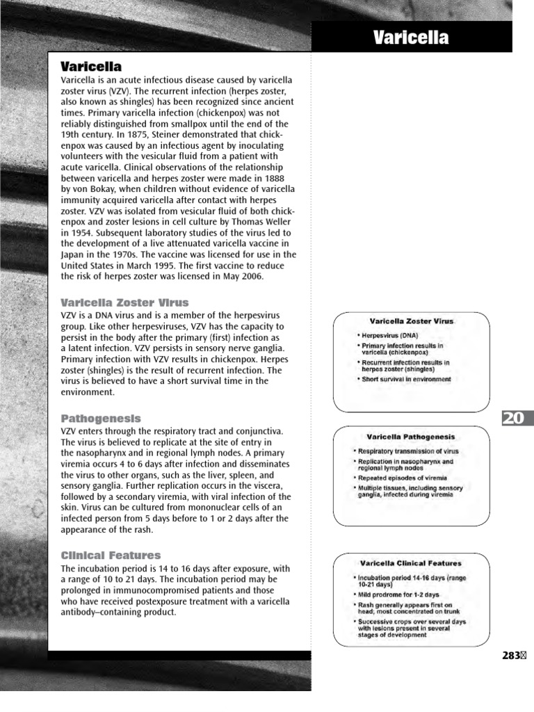 Varicella | PDF