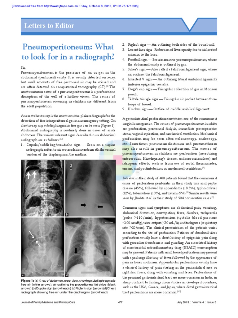 Pneumoperitoneum: What To Look For in A Radiograph? | PDF | Digestive ...