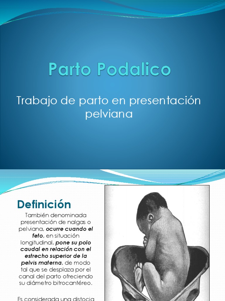 Manejo del Parto Podálico en Embarazo | PDF | Parto | Pelvis