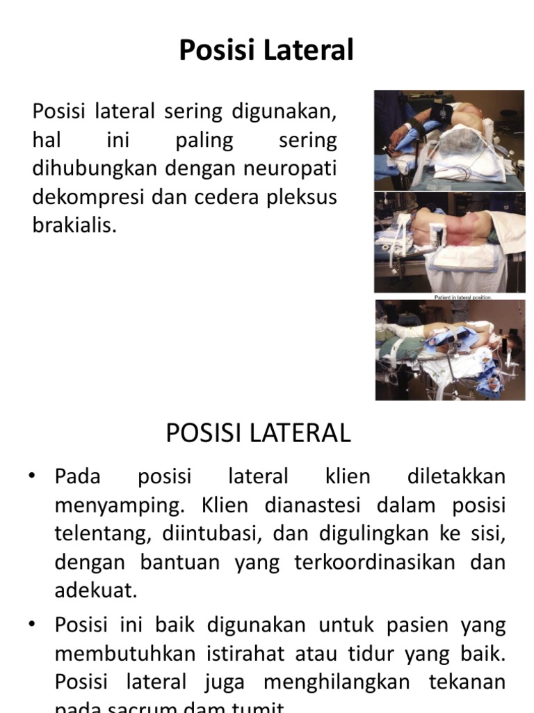 Posisi Lateral | PDF