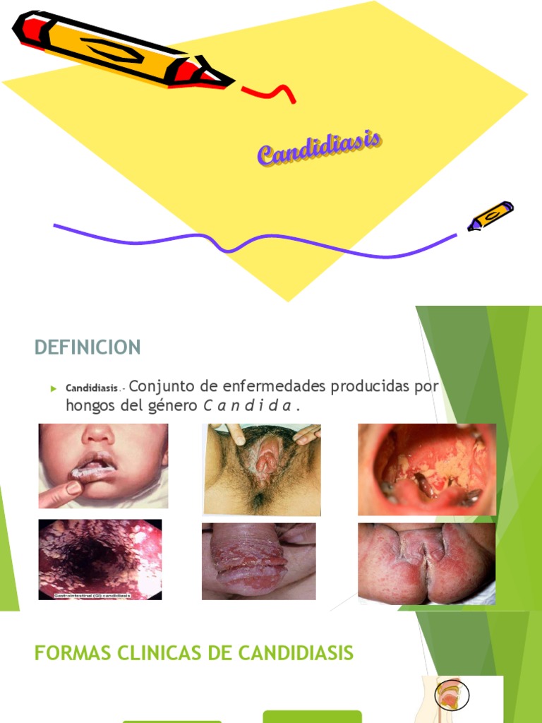 Candidiasis | PDF | Inmunología | Enfermedades y trastornos