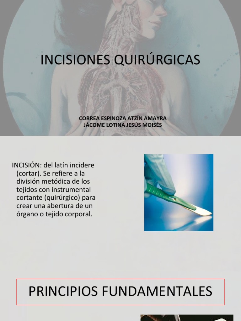 INCISIONES-QUIRÚRGICAS-3.pptx | Abdomen | Tórax