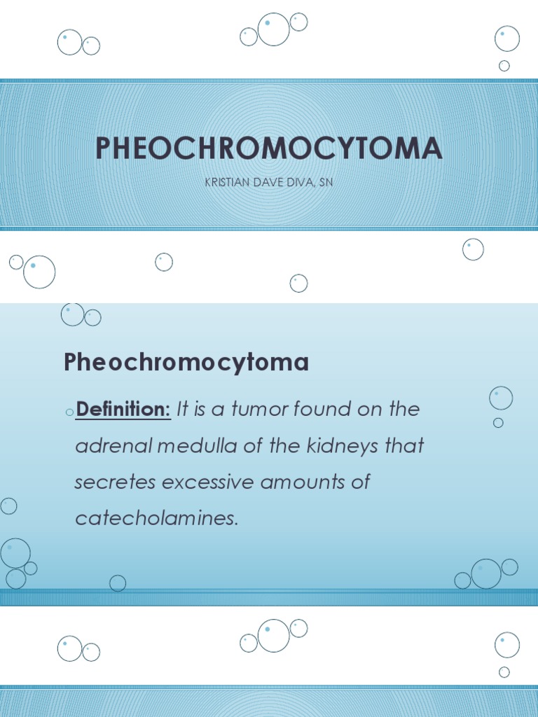 PHEOCHROMOCYTOMA | PDF | Adrenal Gland | Epinephrine