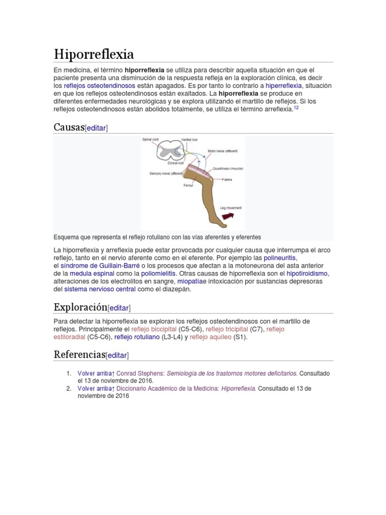 Hiporreflexia: Definición y Causas | PDF