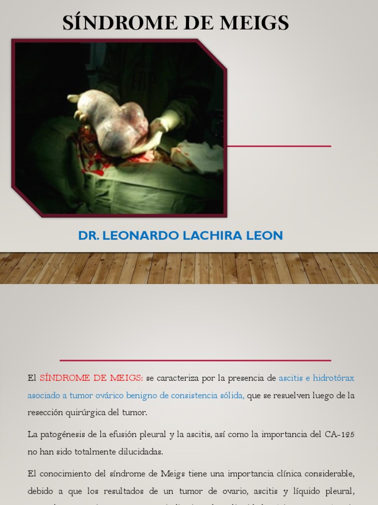 Síndrome de Meigs - Ppt. LLL | PDF | Cáncer | Cáncer de ovarios