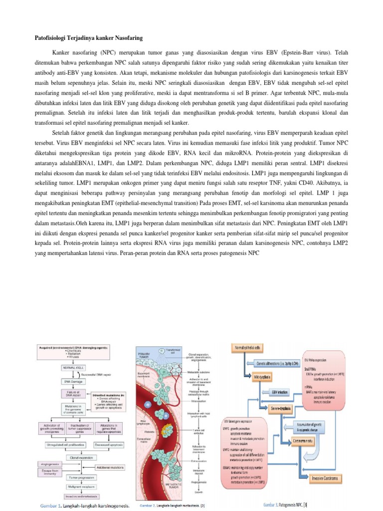 Patofisiologi Terjadinya Kanker Nasofaring | PDF