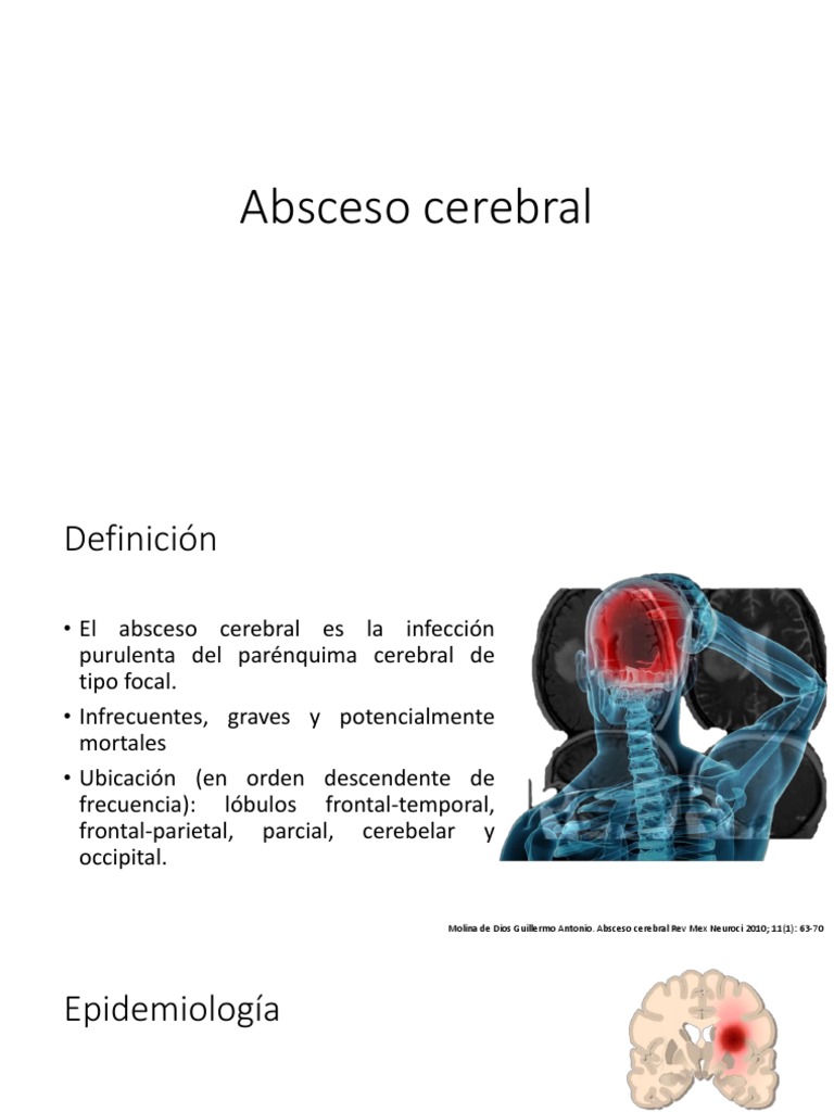 Absceso cerebral: causas y síntomas | PDF | Enfermedades y trastornos ...