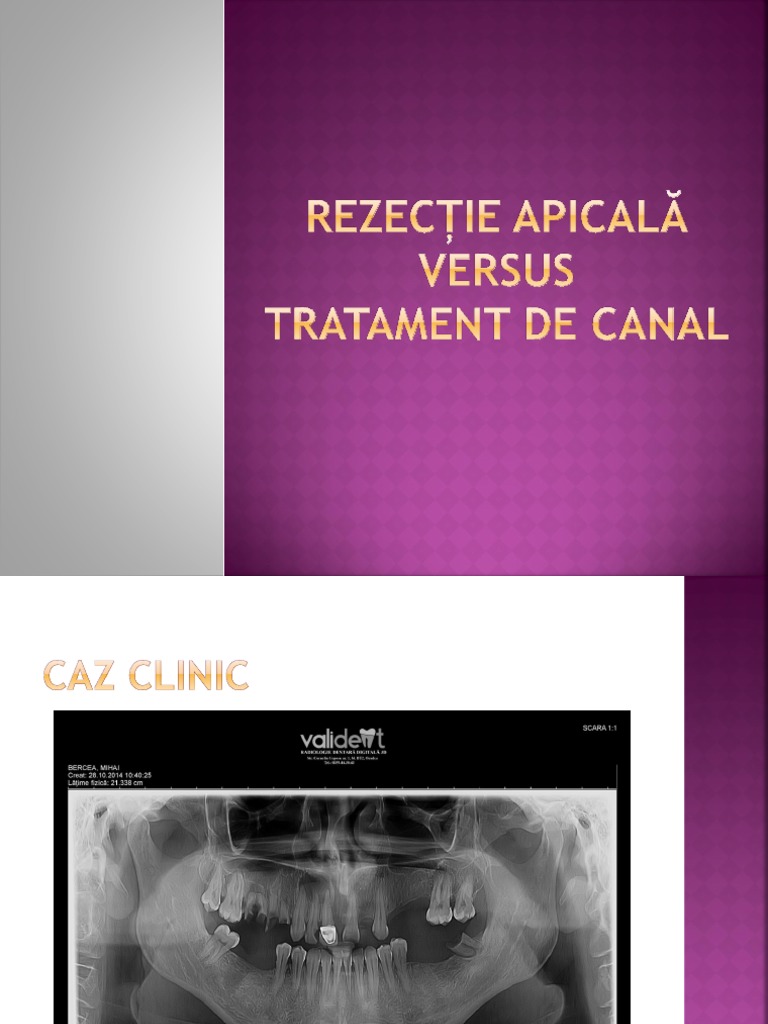 Rezectie Apicala Versus Tratament de Canal | PDF
