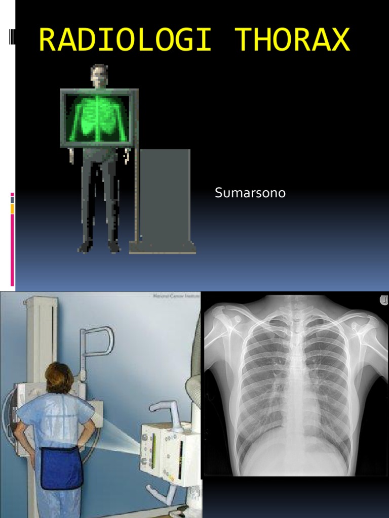 Belajar Baca Thorax Kardiovaskular | PDF | Aorta | Blood Vessel