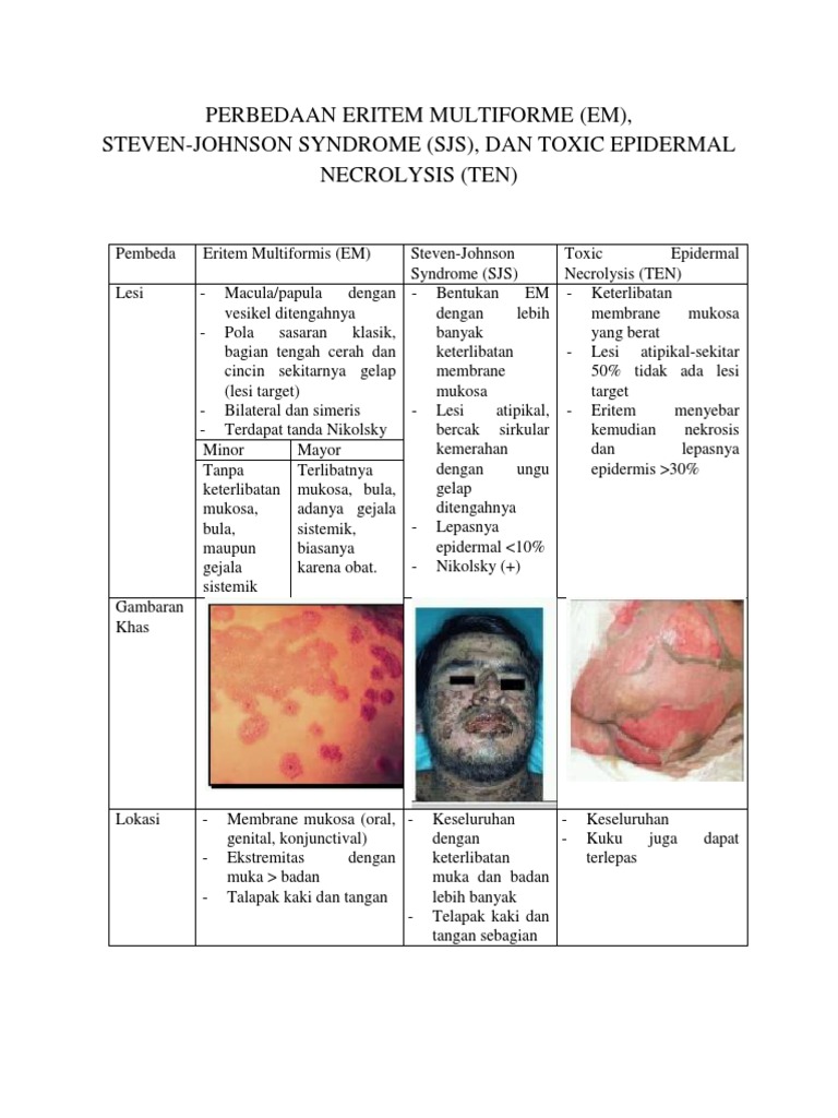 Perbedaan EM, SJS, dan TEN | PDF