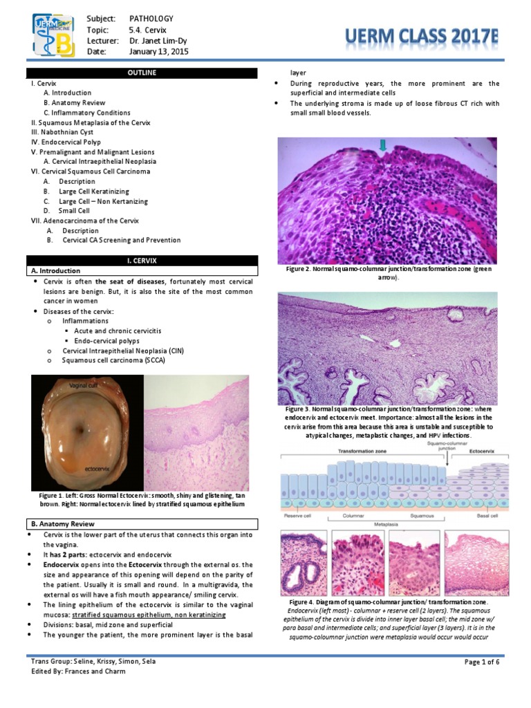 Pathology 5.05a Cervix | Cervical Cancer | Epithelium