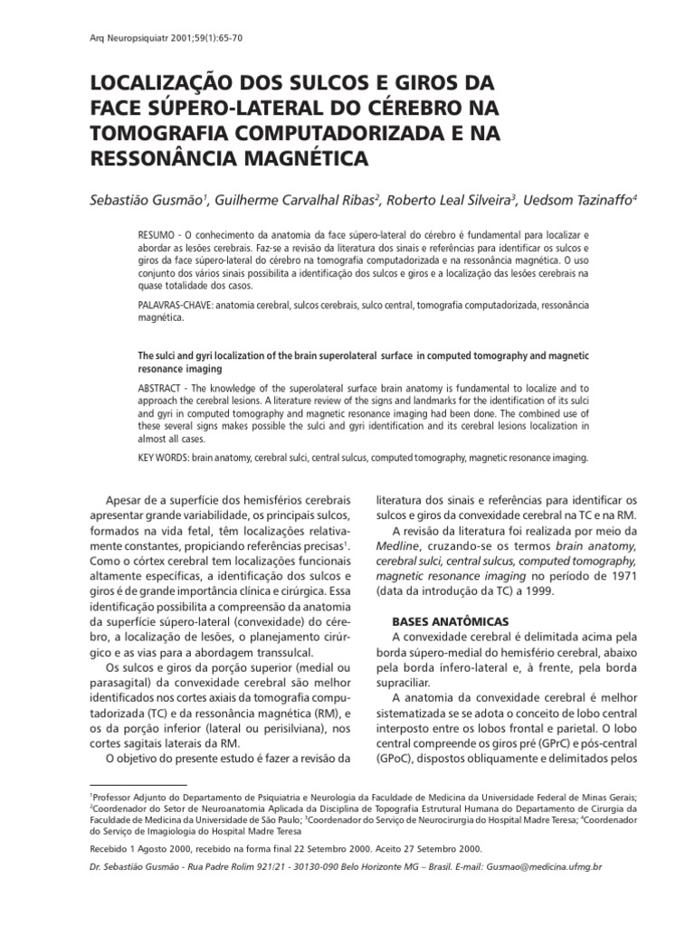 Localização Dos Sulcos e Giros Da Face Súpero-Lateral Do Cérebro Na ...