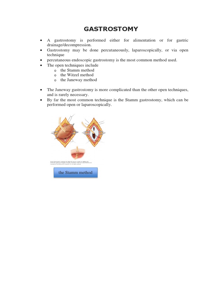 Stamm Gastrostomy Overview | PDF | Self-Improvement | Science & Mathematics