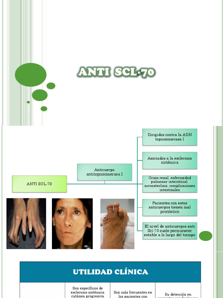 SCL 70 | PDF | Elisa | Medicina CLINICA