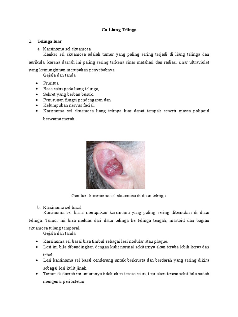 Tumor Telinga: Gejala & Klasifikasi | PDF
