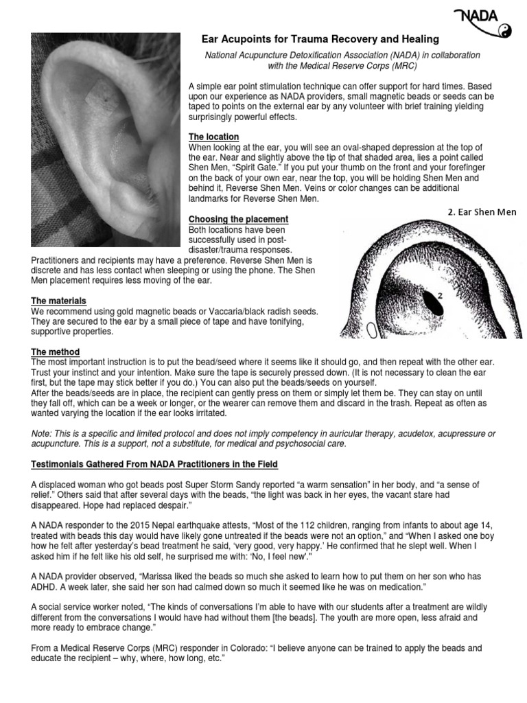 MRC-NADA Handout Ear Acupoints For Trauma Recovery-Finalv2 | PDF ...