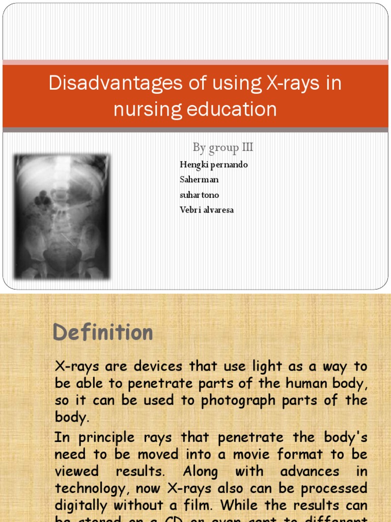 Disadvantages of Using X-Rays in Nursing Education | PDF | X Ray ...