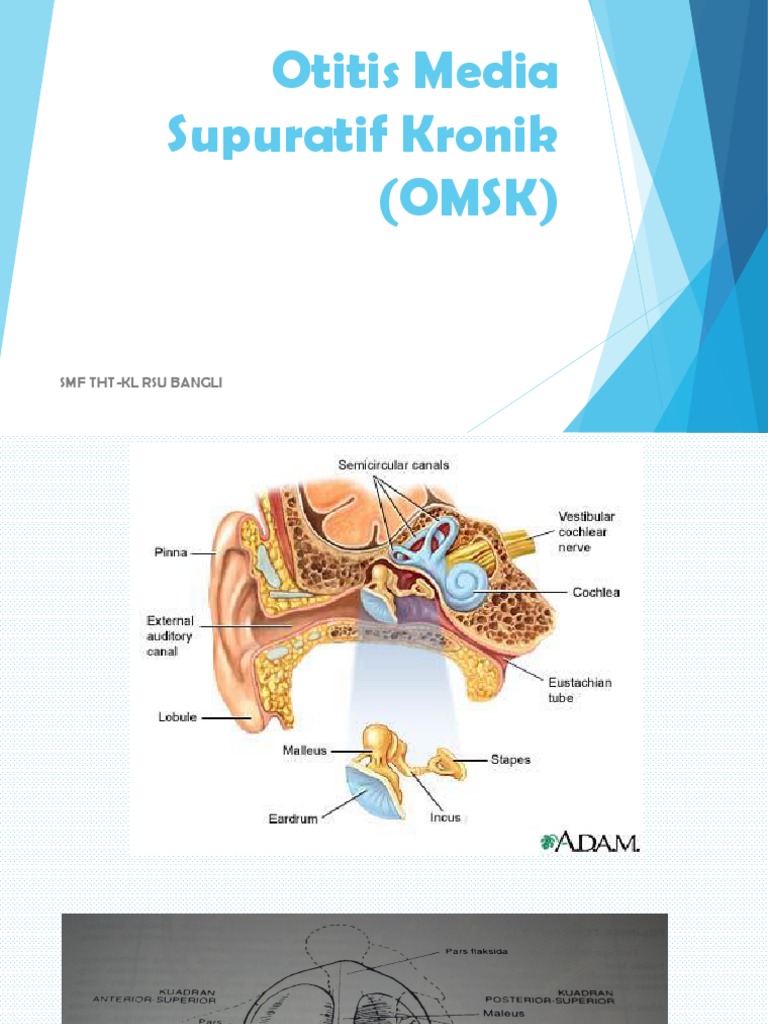 Otitis Media Supuratif Kronik (OMSK) | PDF