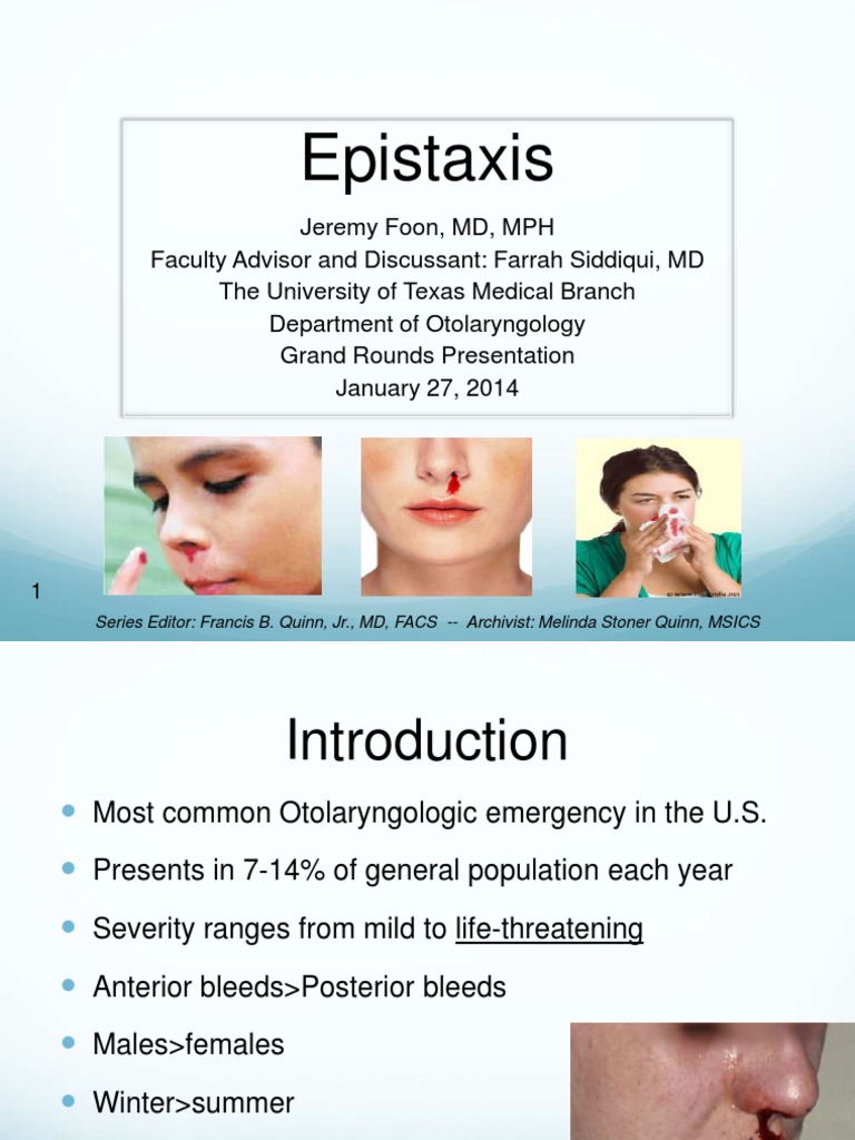 Understanding Epistaxis: Causes & Treatments | PDF | Human Nose | Human ...