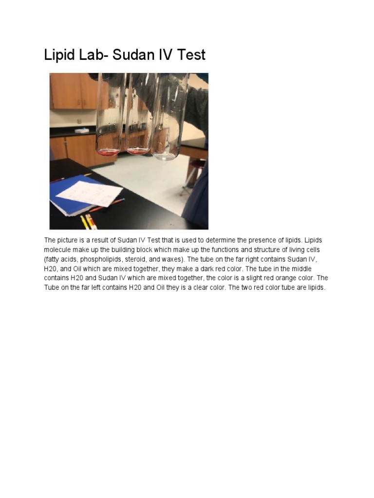 Lipid Lab - Sudan IV Test | PDF