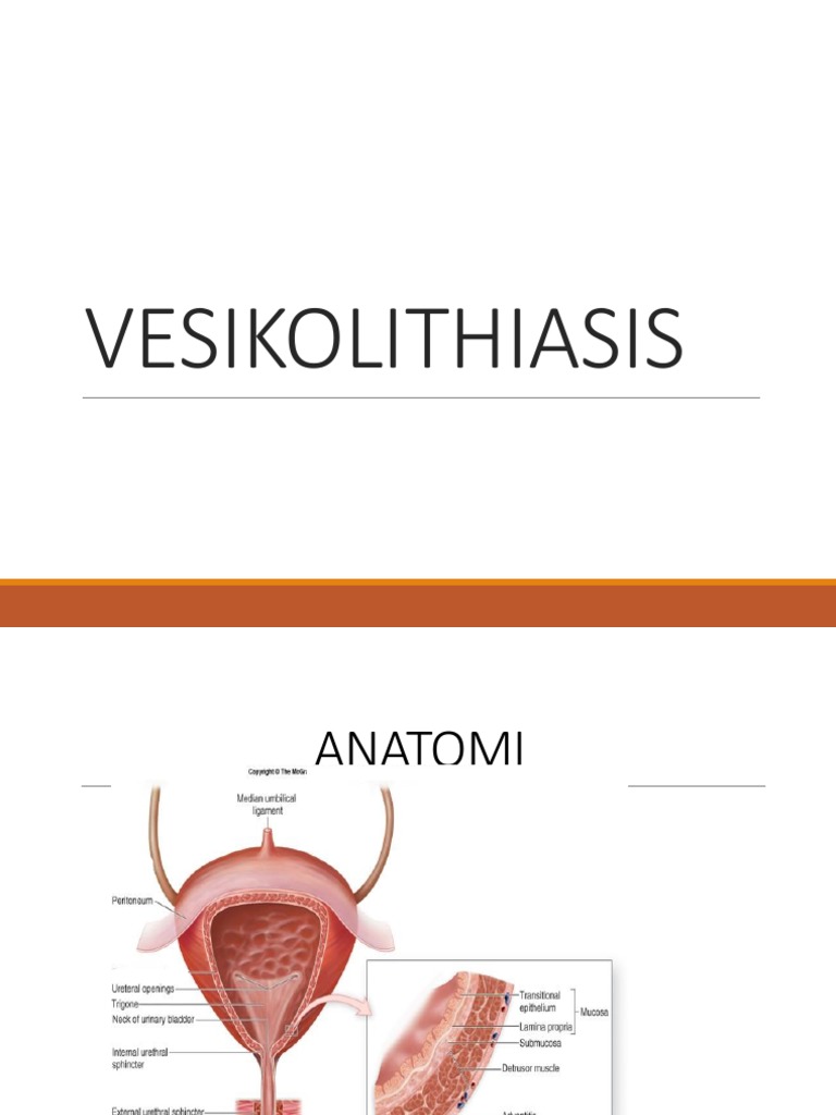 Vesicolithiasis BSH | PDF | Urology | Clinical Medicine