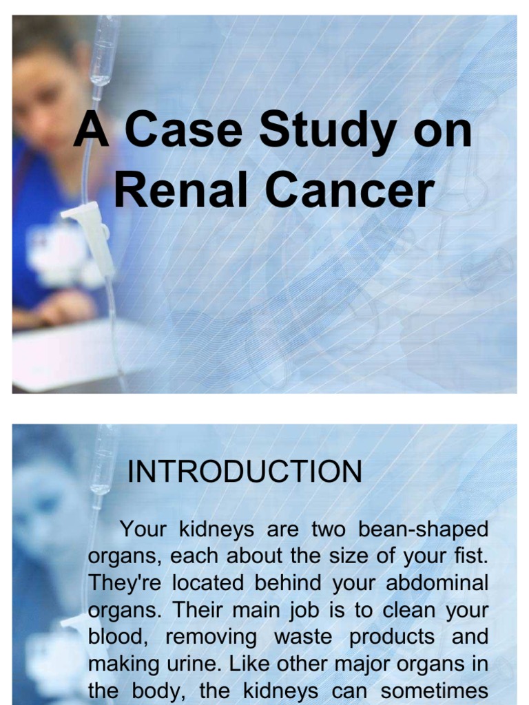A Case Study On Renal Cancer | PDF | Cancer | Kidney