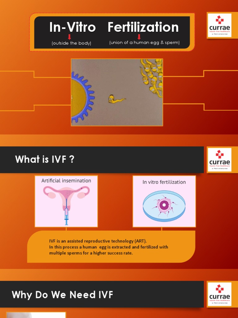 Explore Your Options With in Vitro Fertilization | PDF