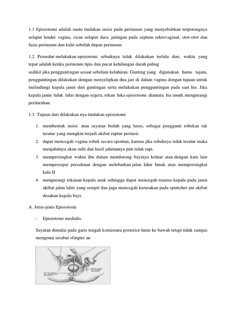 Episiotomi | PDF