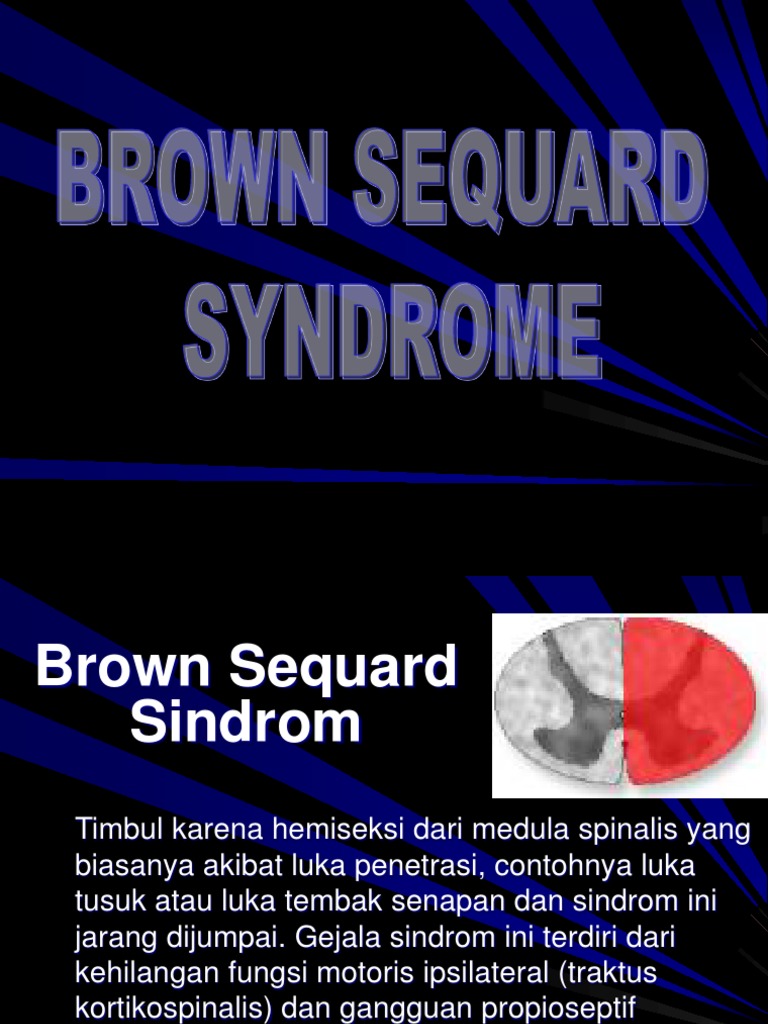 Brown Sequard Sindr | PDF