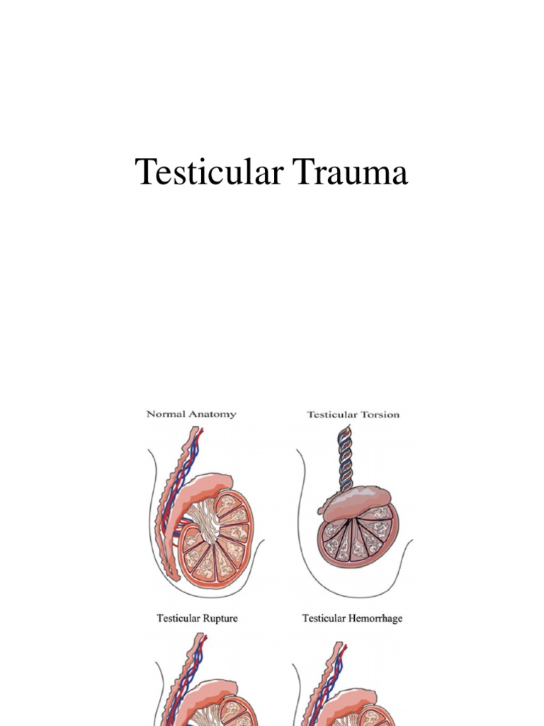 Testicular Trauma: Causes and Treatments | PDF