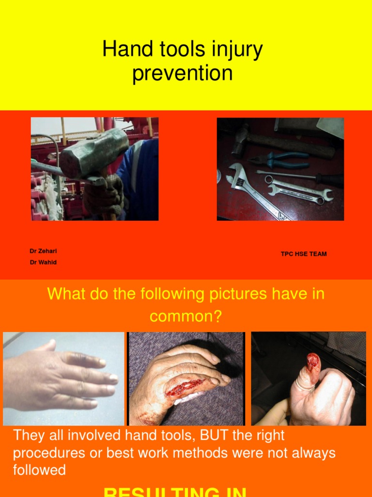 Hand Injuries Safety | PDF | Hammer | Tools