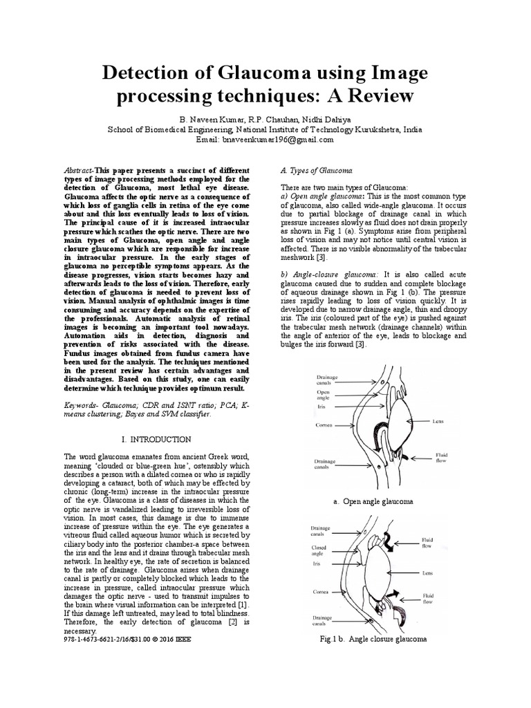 Detection of Glaucoma Using Image Processing Techniques: A Review | PDF ...