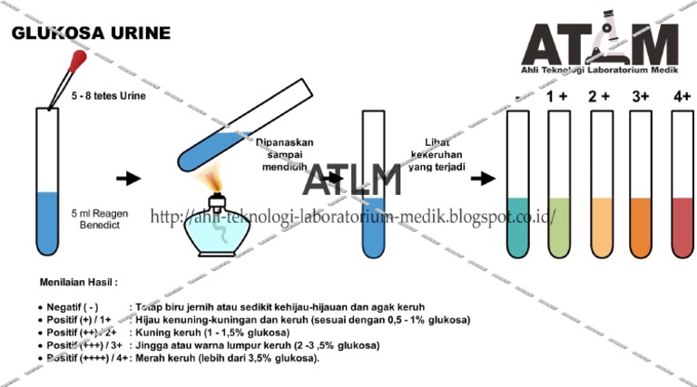 Pemeriksaan Glukosa Urin Cara Benedict | PDF