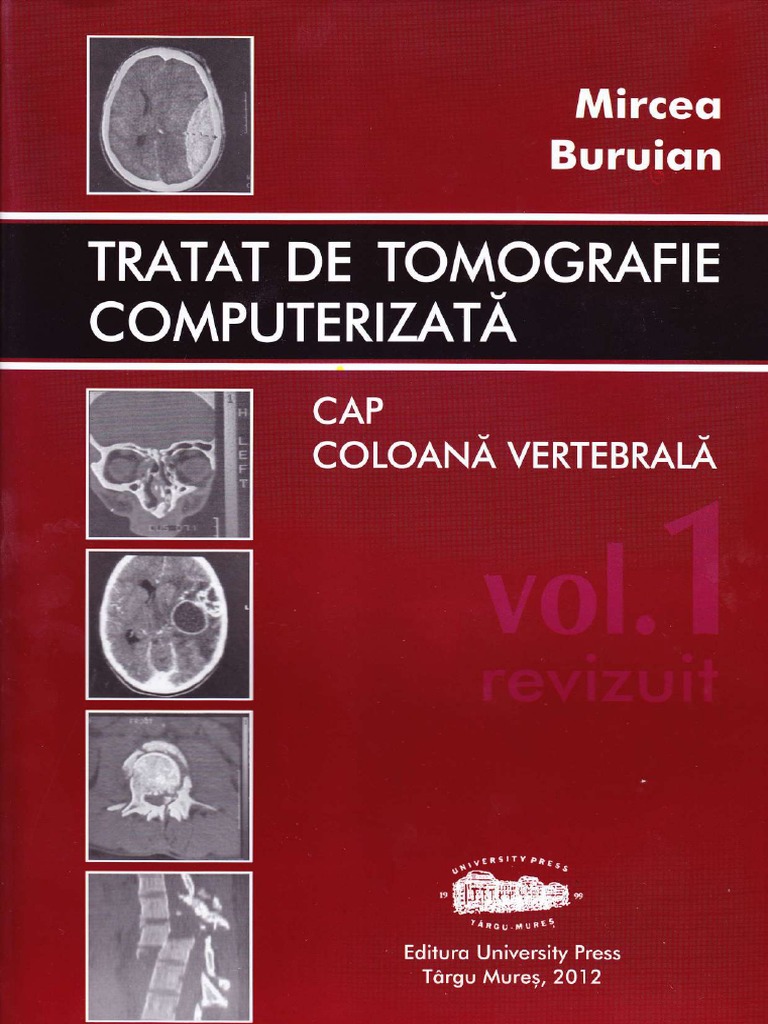 Tratat de Tomografie Computerizata | PDF