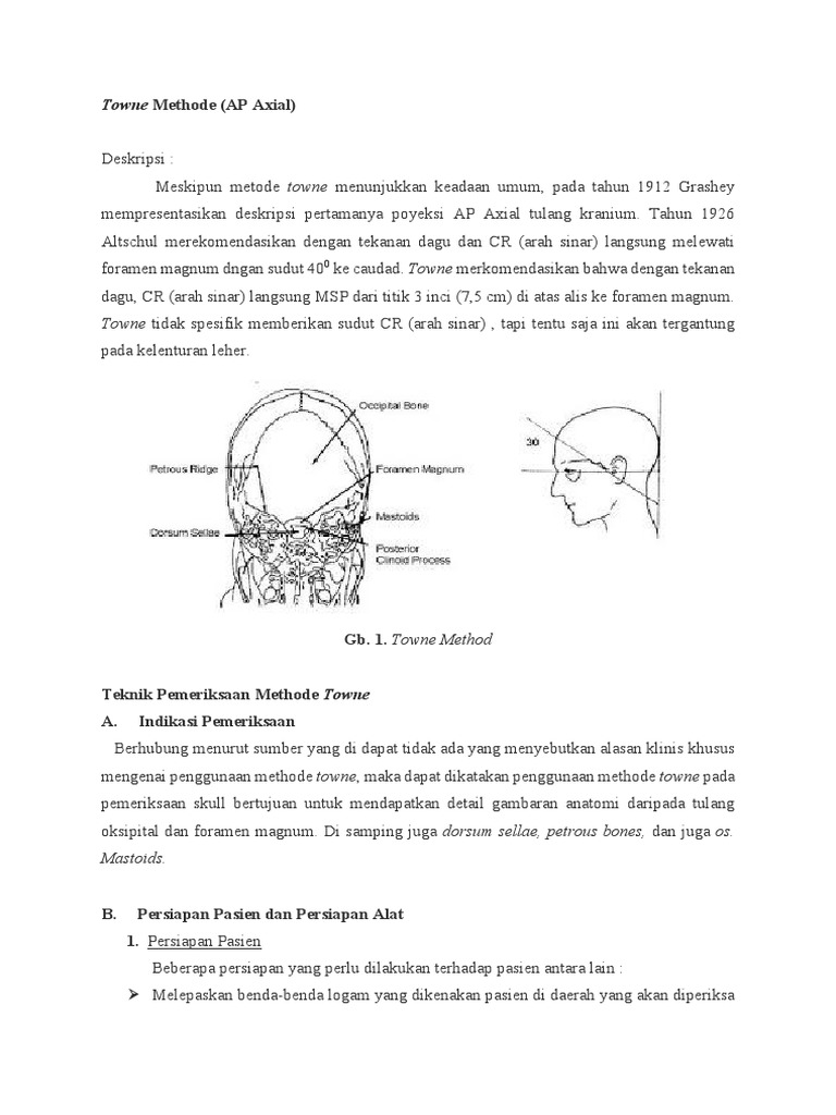 TOWNE METHOD (AP AXIAL PROJECTION) | PDF