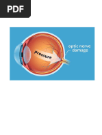 Tangent Screen Visual Field Testing | PDF | Retina | Color