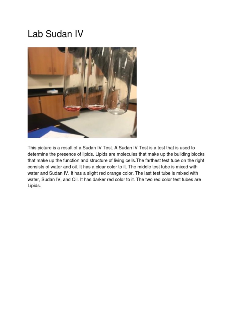 Sudan IV Test for Lipid Detection | PDF